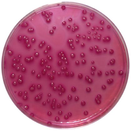 Kit Analisi Alimenti per Ricerca Batteri, Virus e Contaminanti - Generon