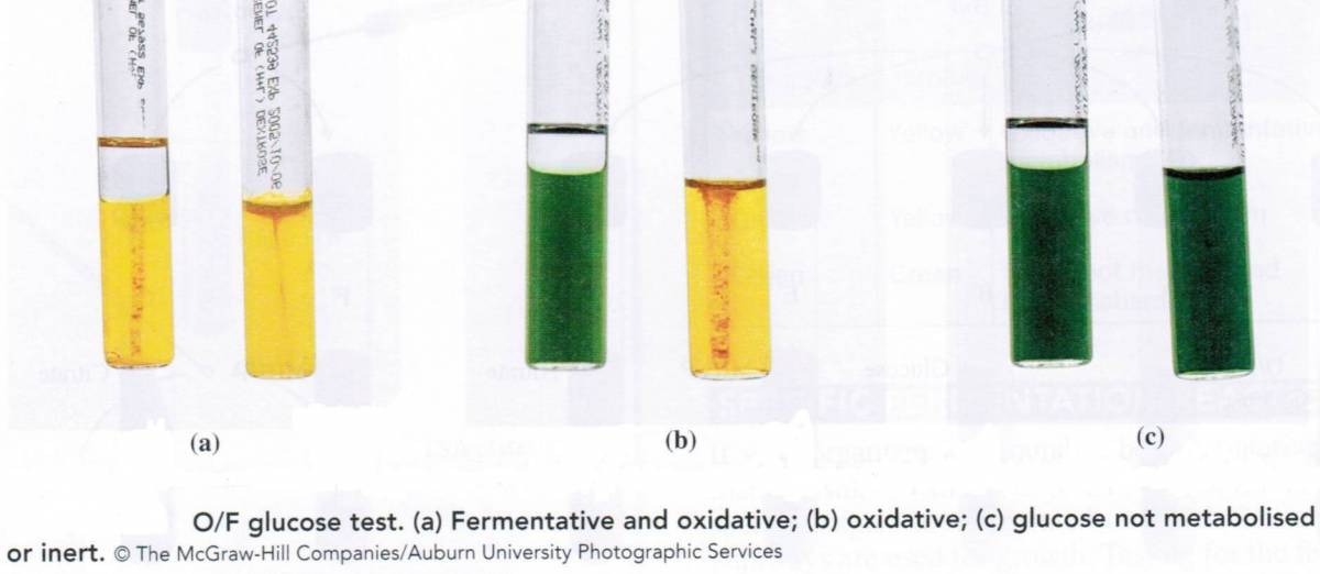 OF GLUCOSE MEDIUM per il test ossidativo / fermentativo del glucosio ...
